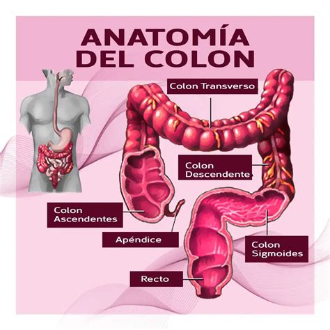 Dieta para Colitis: Descubre Qué Alimentos Comer y Cuáles Evitar para ...
